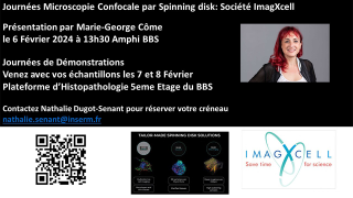 Journées Microscopie Confocale par Spinning disk : Société ImagXcell :: Département SBM